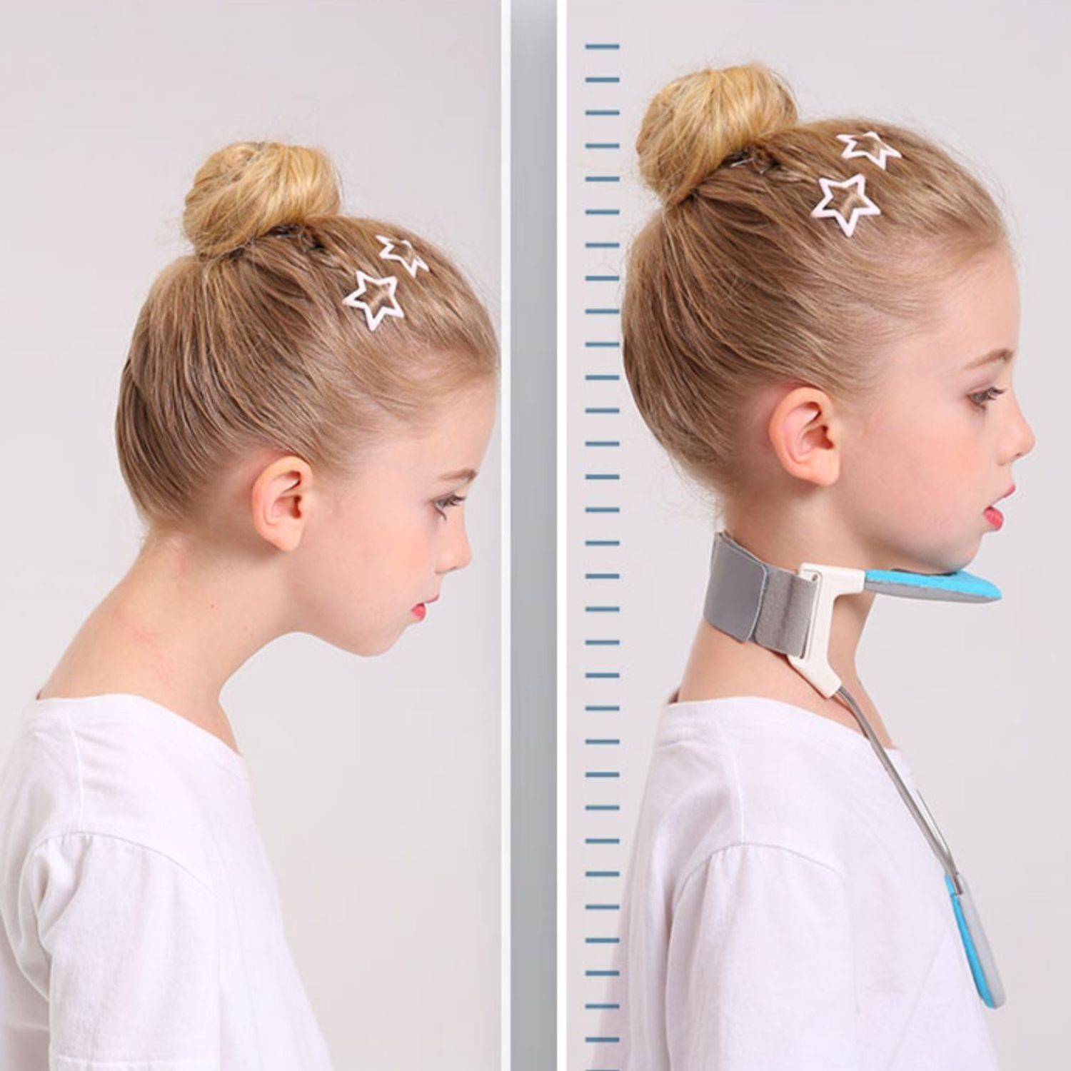 Neck Brace, Neck Support, Neck Brace For Posture, Neck Posture ...